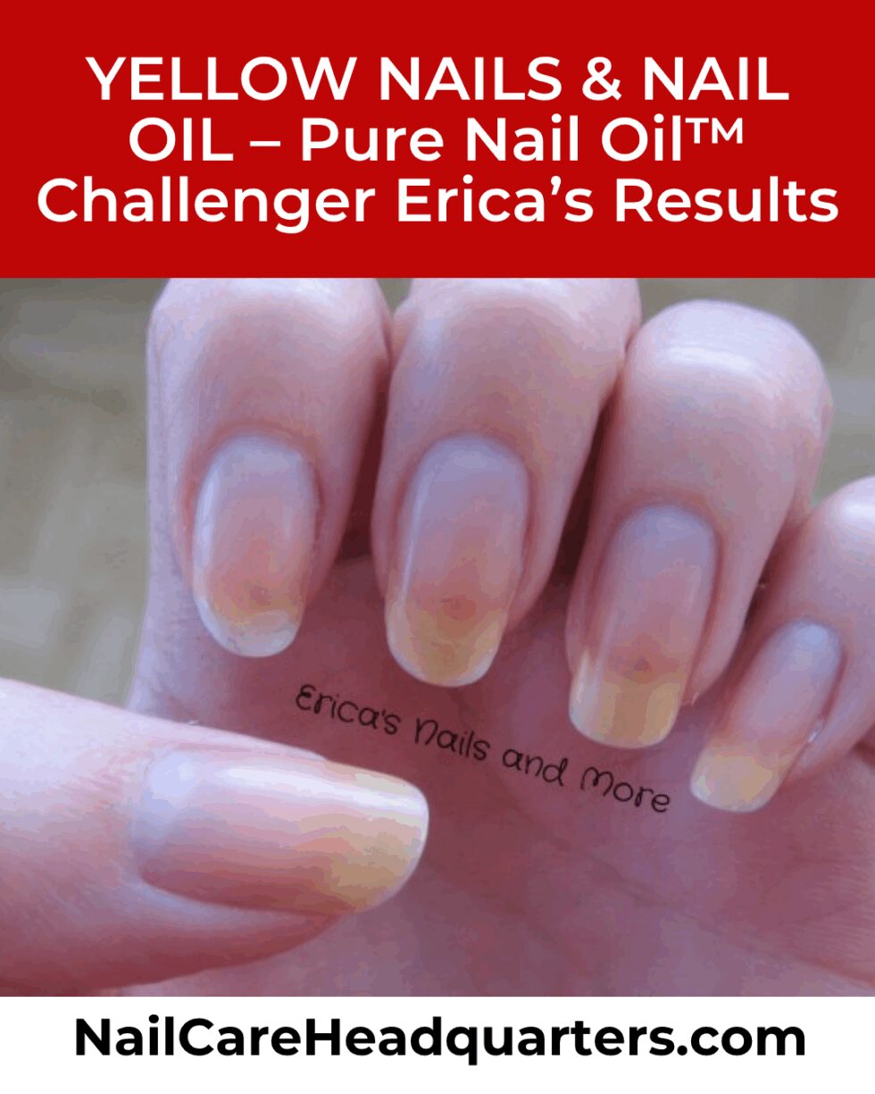 Clear Fingernails & Health Issues | Nail Care Headquarters