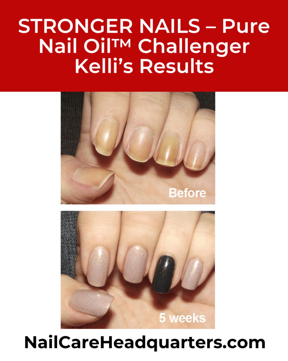 Clear Fingernails & Health Issues | Nail Care Headquarters