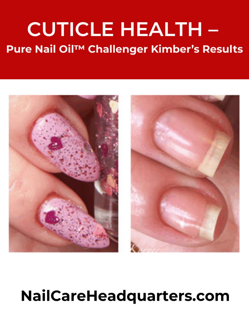 The Cuticle – Should You Clip, Push, or Scrape? | Nail Care Headquarters