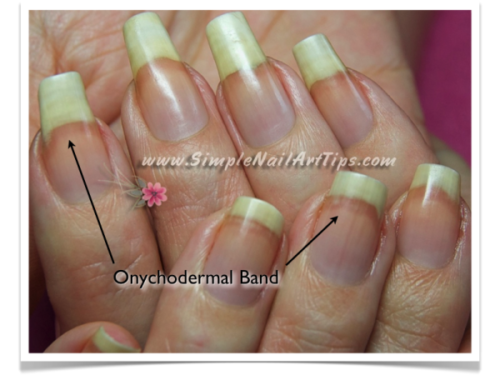 Is My Nail Separating From the Nail Bed? | Nail Care Headquarters