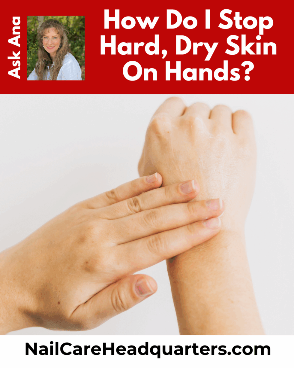 Ask Ana – How Do I Stop Hard, Dry Skin On Hands? | Nail Care Headquarters
