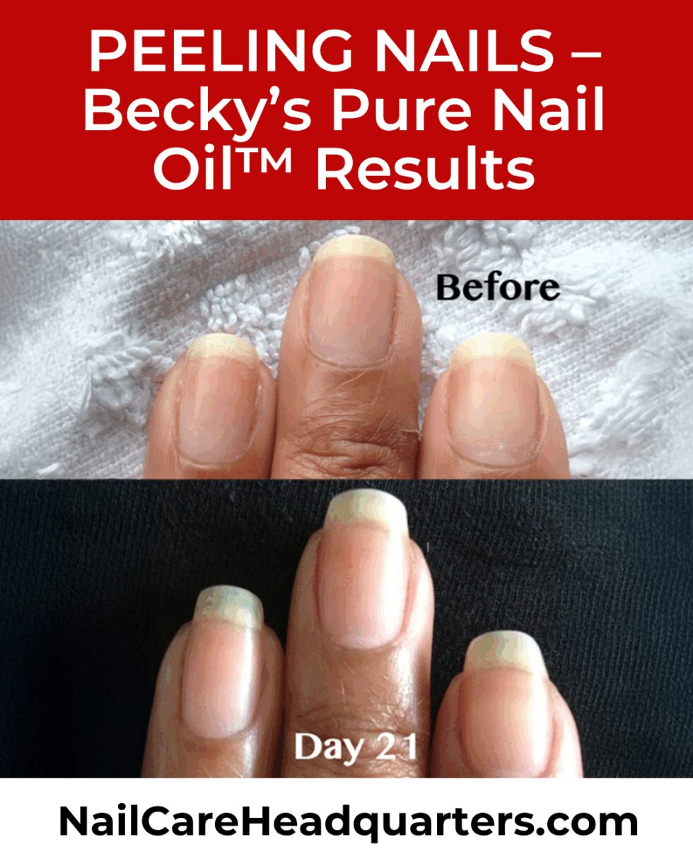 The Cuticle – Should You Clip, Push, or Scrape? | Nail Care Headquarters