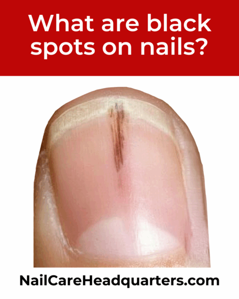 Clear Fingernails & Health Issues | Nail Care Headquarters