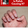 Clear Fingernails & Health Issues | Nail Care Headquarters