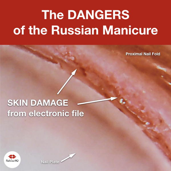 The DANGER and Pain of the Russian Manicure | Nail Care Headquarters
